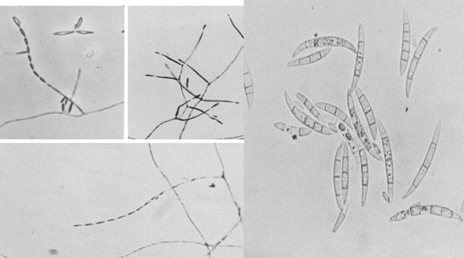 Combined Approach of Morphological and Molecular Diagnosis of Fusaria ...