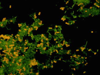 Megasphaera as Lactate-Utilizing Hydrogen-Producing Bacteria | SpringerLink
