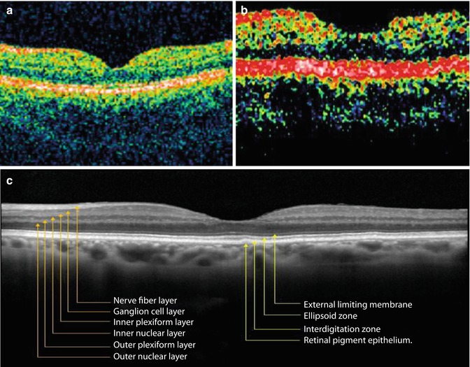 En Face Optical Coherence Tomography | SpringerLink