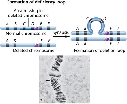 Structural Changes in Chromosomes | SpringerLink