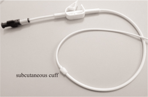 Type of Devices for Mid- and Long-term Venous Access | SpringerLink