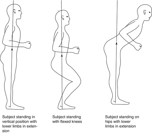 Dynamic Posturography | SpringerLink