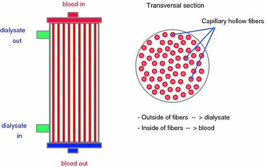 Continuous Renal Replacement Therapy (CRRT) in Intensive Care ...