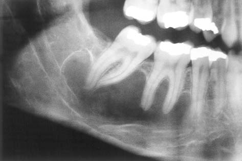 Afwijkingen van het kaakbot | SpringerLink