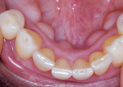 Afwijkingen van het kaakbot | SpringerLink
