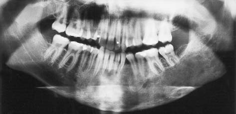 Afwijkingen van het kaakbot | SpringerLink
