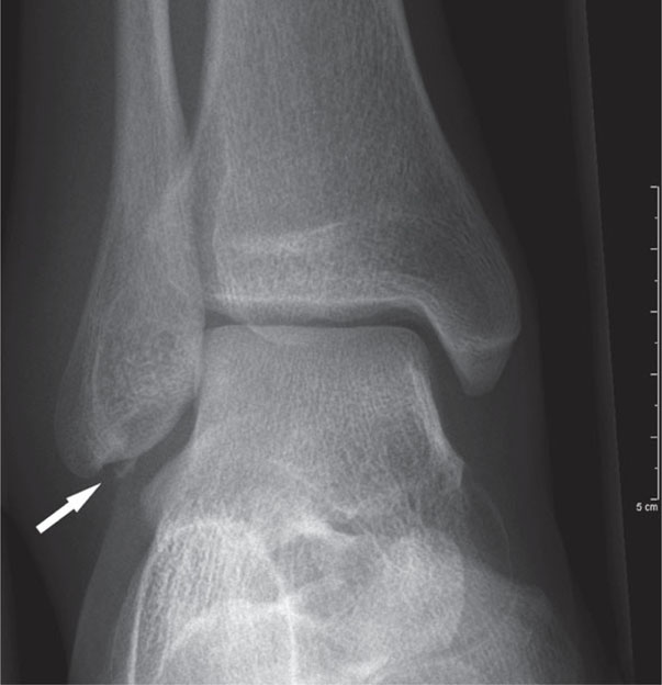 39 Enkel | SpringerLink