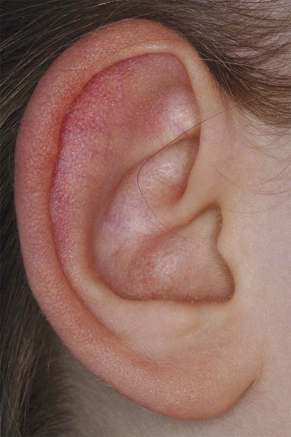 1 Anatomie en fysiologie van het oor | SpringerLink