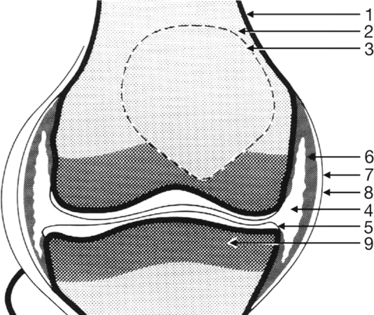 1 Wat is reuma? | SpringerLink