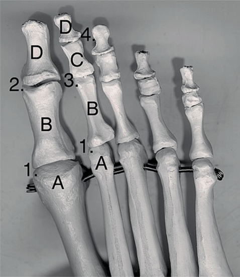 7 Afwijkende teen- en vissngerstanden | SpringerLink