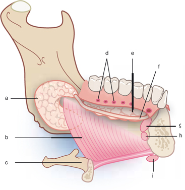 9 Dentogene ontstekingen | SpringerLink