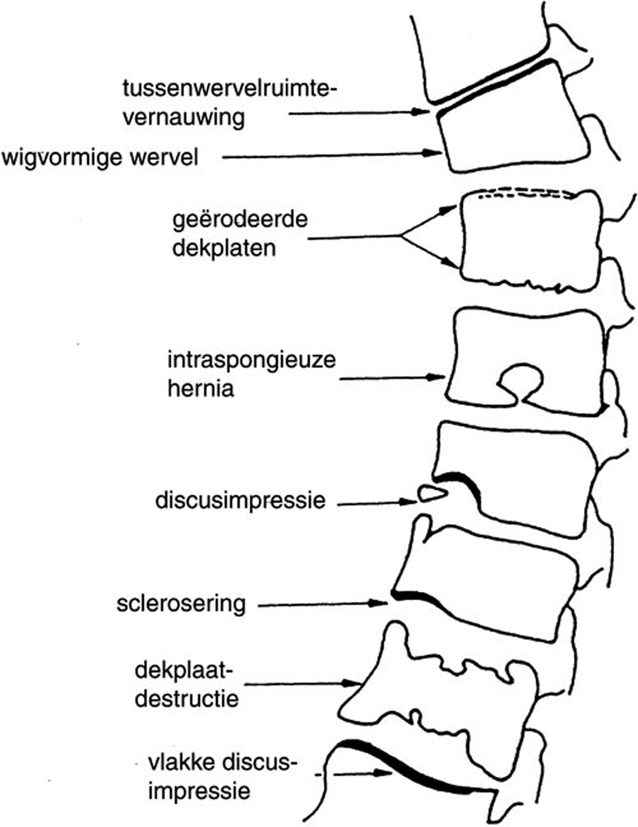 Rugblessures door sport | SpringerLink