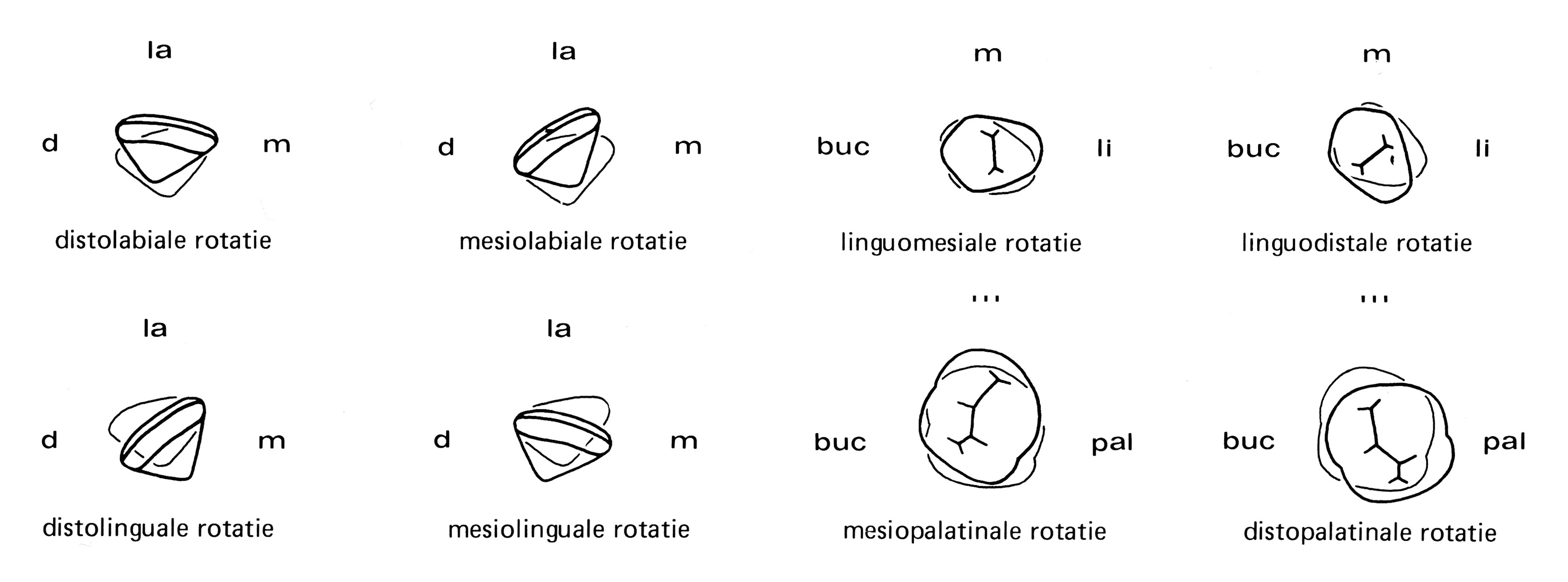 10 Afwijkingen in tandbogen | SpringerLink