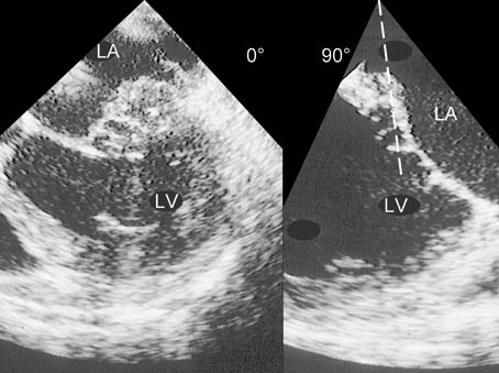 12 De mitralisklep | SpringerLink