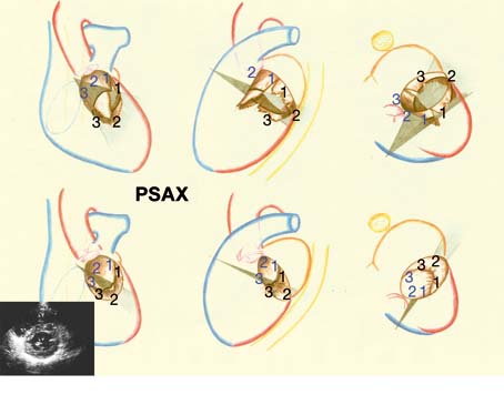 12 De mitralisklep | SpringerLink