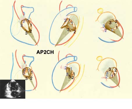 12 De mitralisklep | SpringerLink