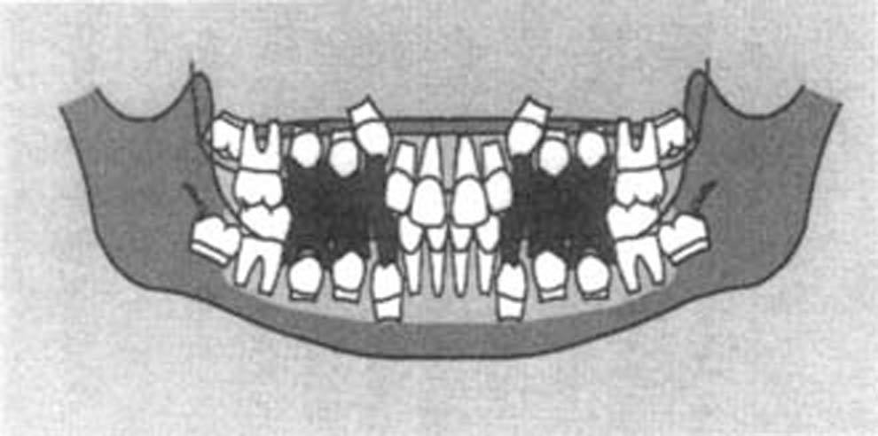 Ontwikkeling en groei van schedel, gelaat en gebit | SpringerLink