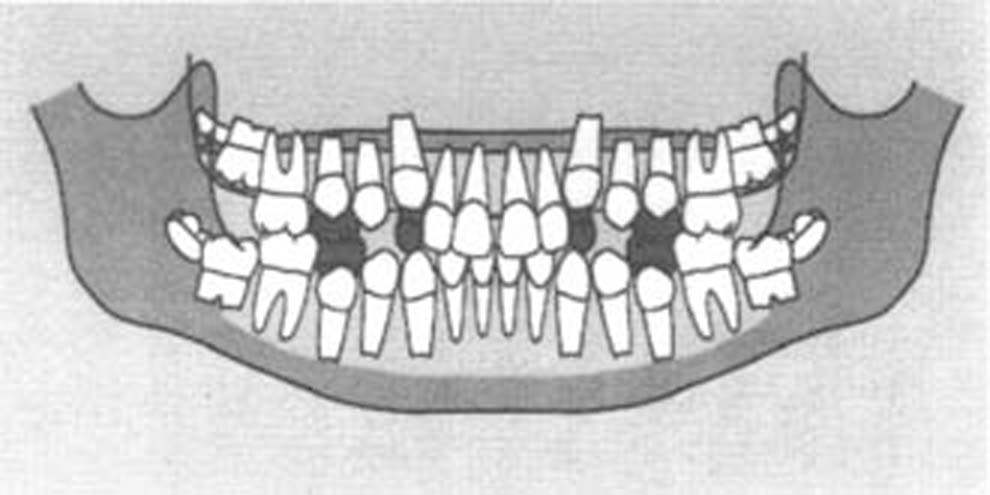 Ontwikkeling en groei van schedel, gelaat en gebit | SpringerLink