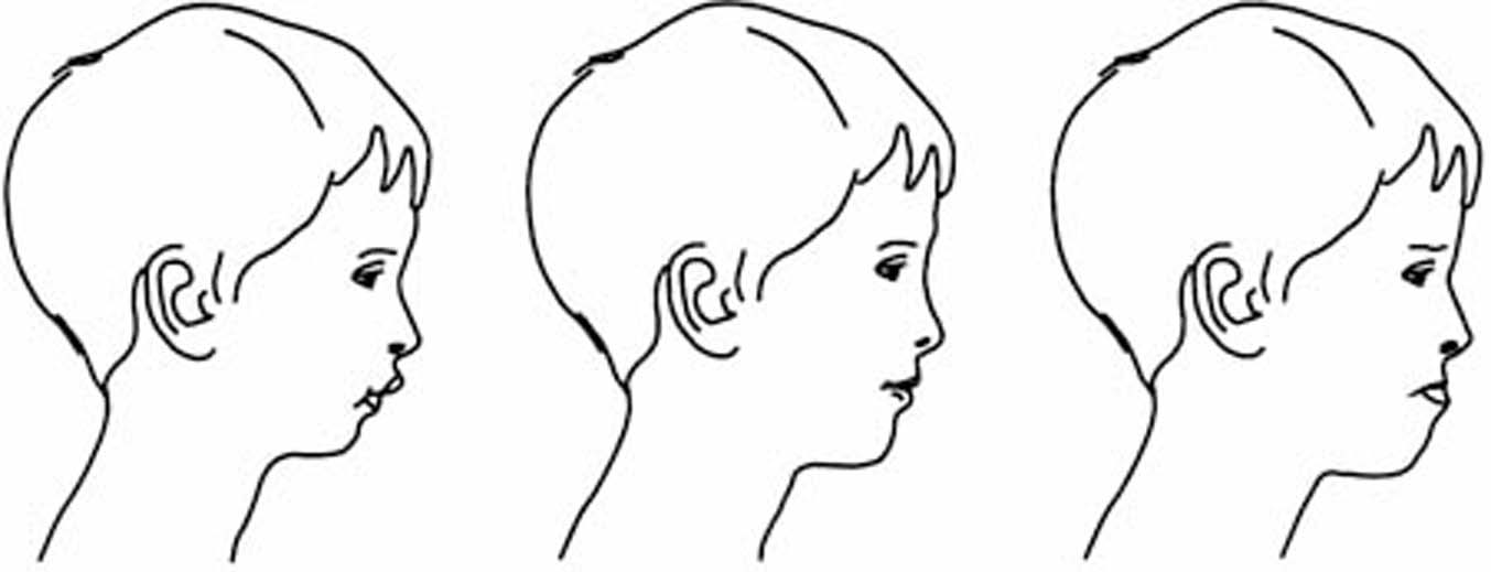 Ontwikkeling en groei van schedel, gelaat en gebit | SpringerLink