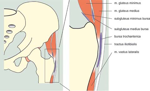 Addendum: tendinose van heupabductoren als oorzaak van het trochanter major pijnsyndroom ...