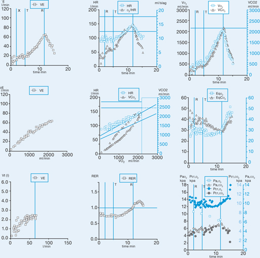 9 Fietsergometrie | SpringerLink