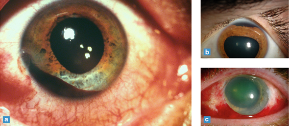 Trauma’s | SpringerLink