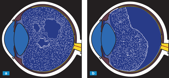Vlekken en flitsen | SpringerLink