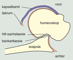 Een 24-jarige hockeyspeelster met een schouderontwrichting | SpringerLink