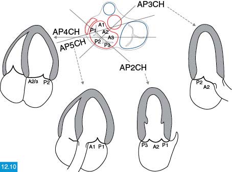 De mitralisklep | SpringerLink
