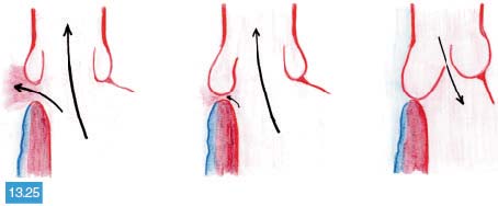 De aortaklep | SpringerLink