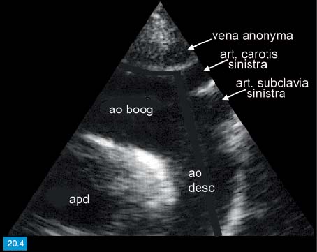 Aorta thoracalis en abdominalis | SpringerLink