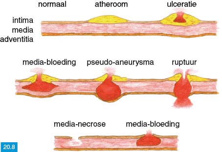 Aorta thoracalis en abdominalis | SpringerLink