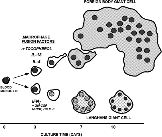 Macrophage Fusion and Multinucleated Giant Cells of Inflammation ...
