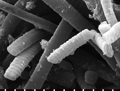 Cyanobacterial Mats and Stromatolites | SpringerLink