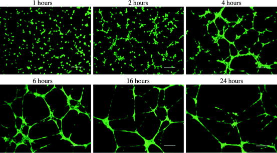 The In Vitro Endothelial Cell Tube Formation Assay in 3D Culture on ...