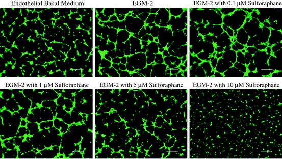 The In Vitro Endothelial Cell Tube Formation Assay in 3D Culture on ...