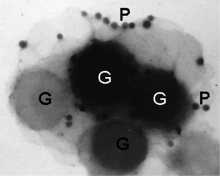 Plastoglobuli, Thylakoids, Chloroplast Structure and Development of ...