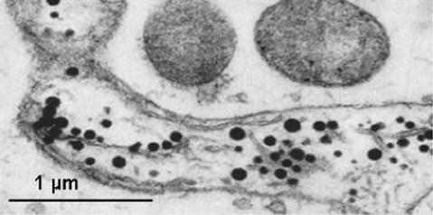 Plastoglobuli, Thylakoids, Chloroplast Structure and Development of ...