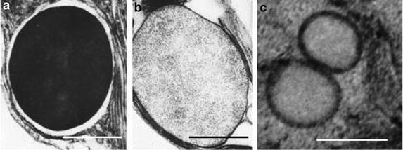Plastoglobuli, Thylakoids, Chloroplast Structure and Development of ...