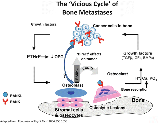 Pathophysiology of Bone Metastases | SpringerLink