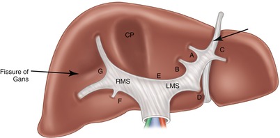 Glisson’s Pedicle Approach and Liver Round Ligament Approach in ...
