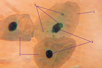 Chlamydia pneumoniae Pneumonia | SpringerLink