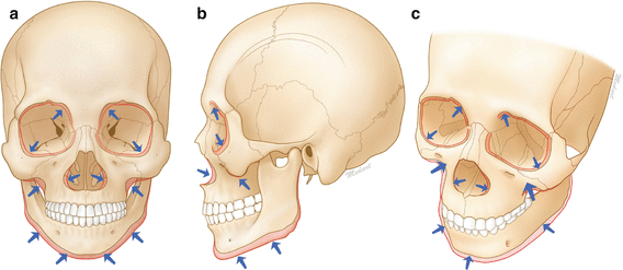 General Anatomy of the Face and Neck | SpringerLink