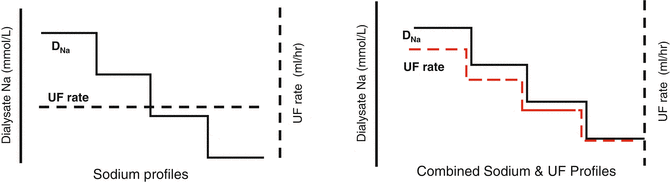 Complications of Hemodialysis | SpringerLink