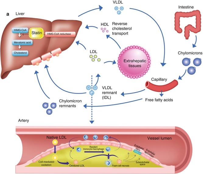 Cholesterol Management After Stroke | SpringerLink