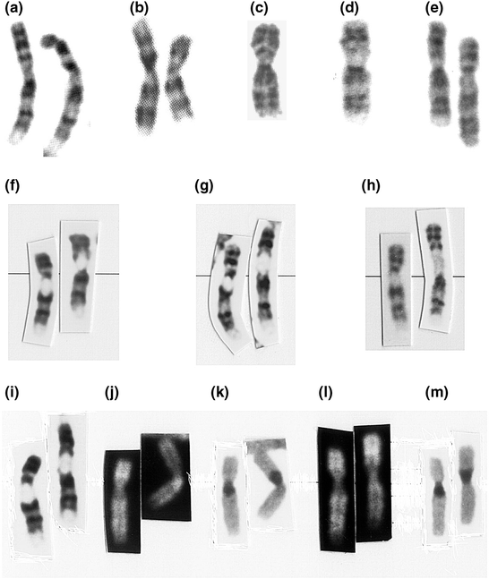 Chromosome Heteromorphism (Summaries) | SpringerLink