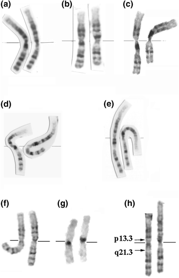 Chromosome Heteromorphism (Summaries) | SpringerLink