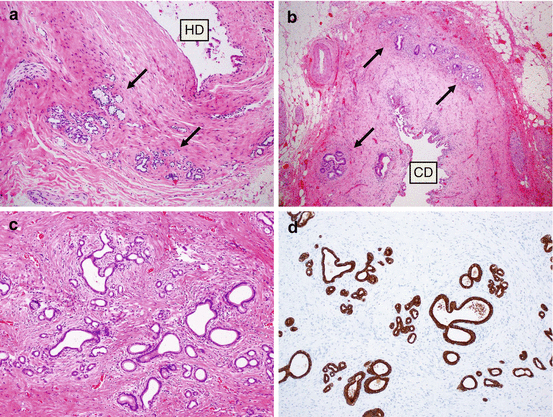 Development and Anatomy of the Bile Duct | SpringerLink