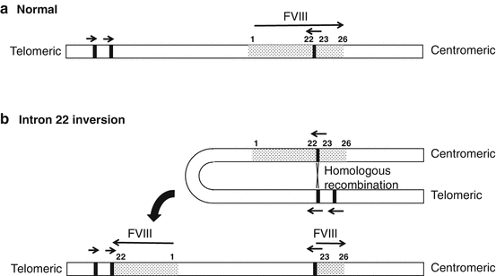 Pathogenesis and Treatment of Hemophilia | SpringerLink