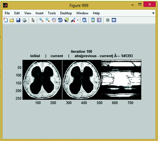 Artifacts Correction in MRI Images | SpringerLink